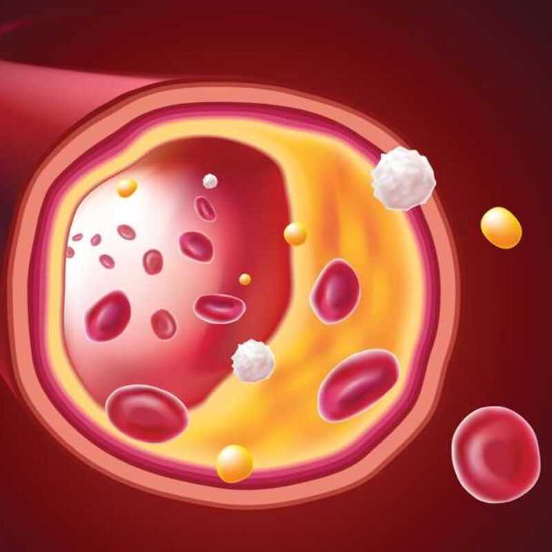 Nutrition Supplements – Cancer A-Z